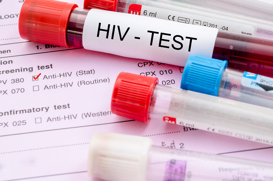 Emergency HIV Testing - SignatureCare Emergency Center ER