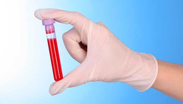 Using Blood Test for Early Cancer Diagnosis