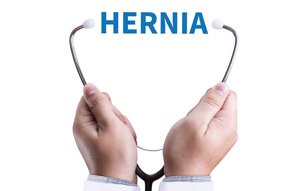 Understanding Hernia, Causes, Diagnosis & Treatment of Hernia