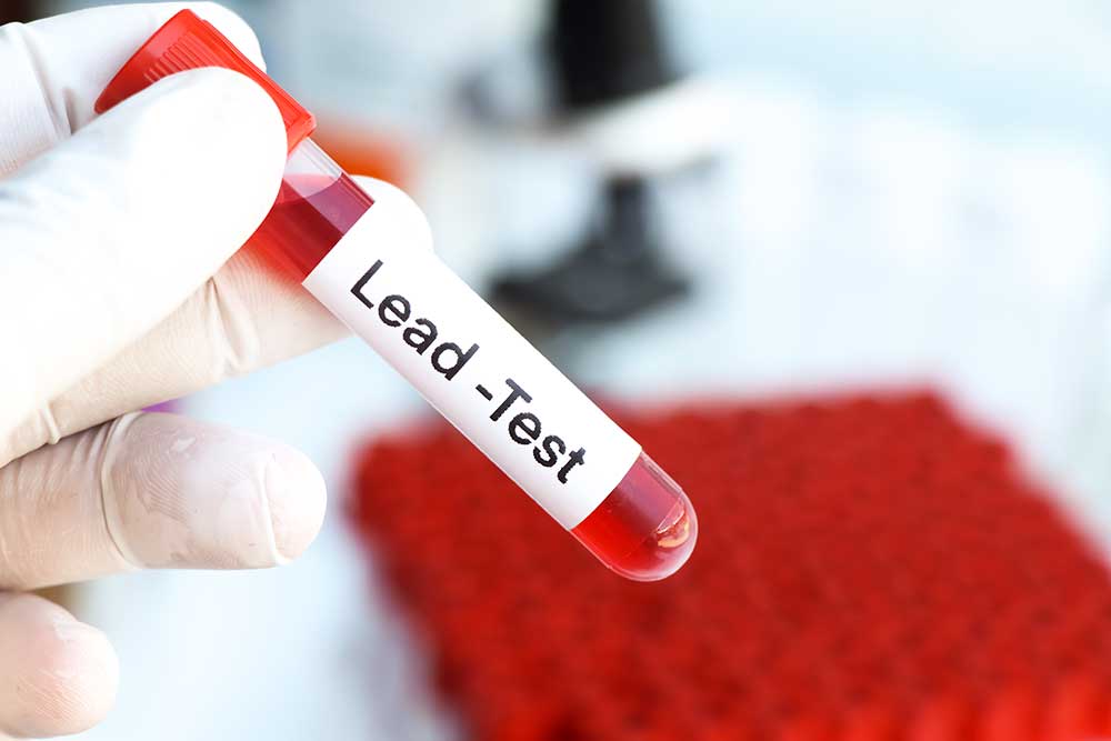 Why lead Exposure can be Dangerous to your Kids | Emergency Room